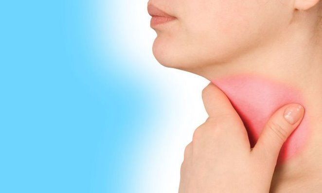 O que é Amigdalite ? Sintomas e tratamentos - Osasco Notícias