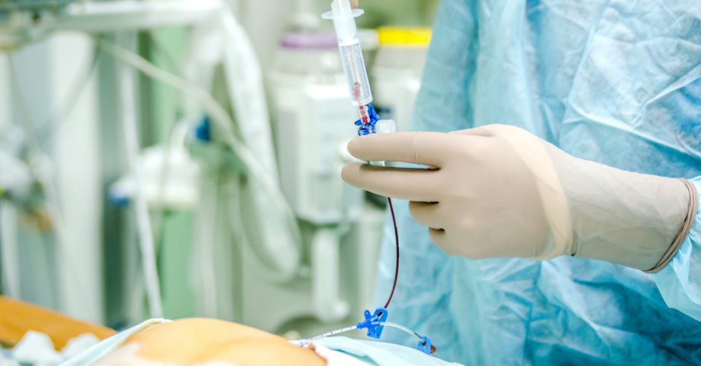 Cateterismo: O que é e é seguro fazer? - Osasco Notícias